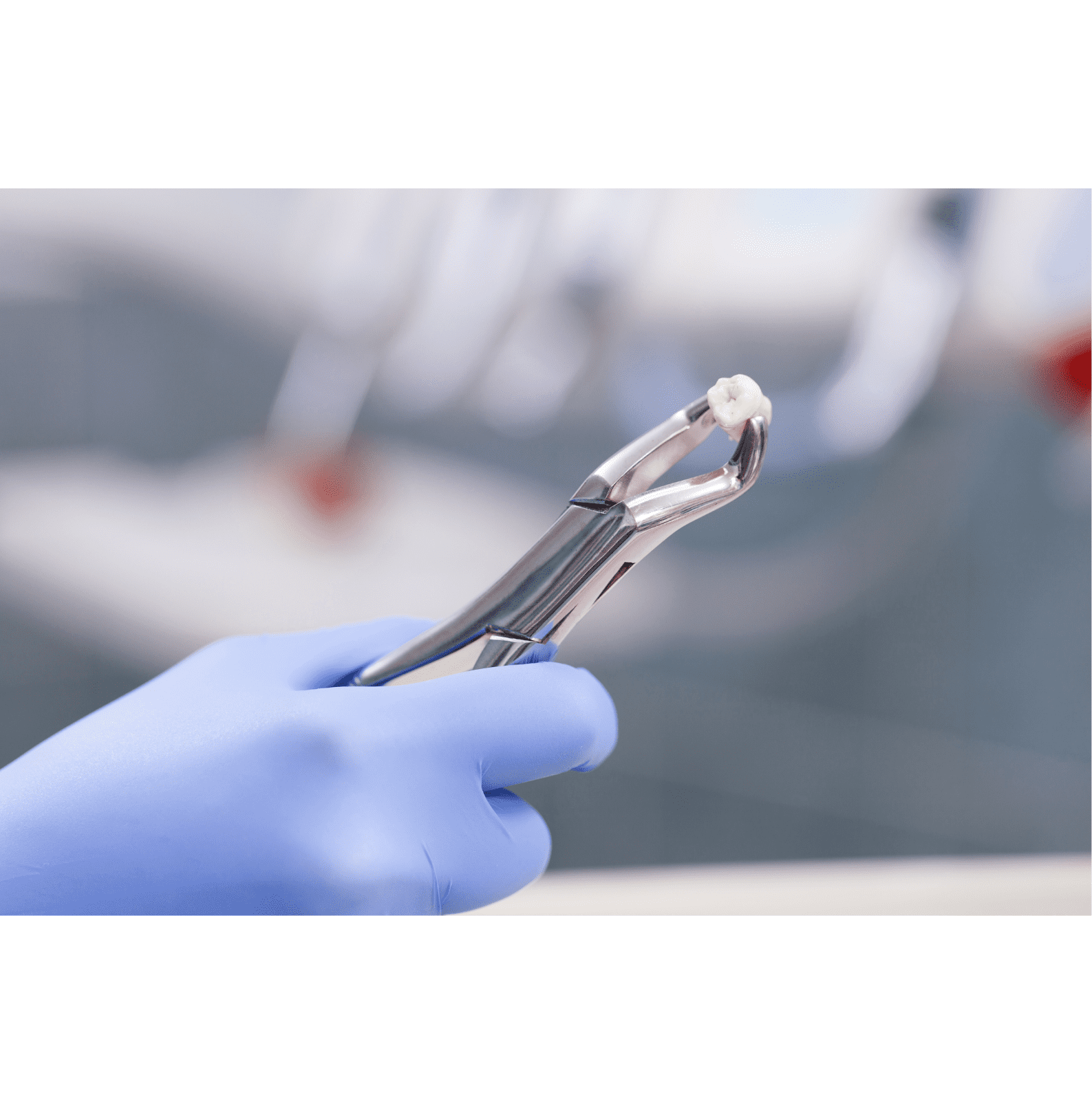 Can You Fly After Tooth Extraction | Is It Safe?