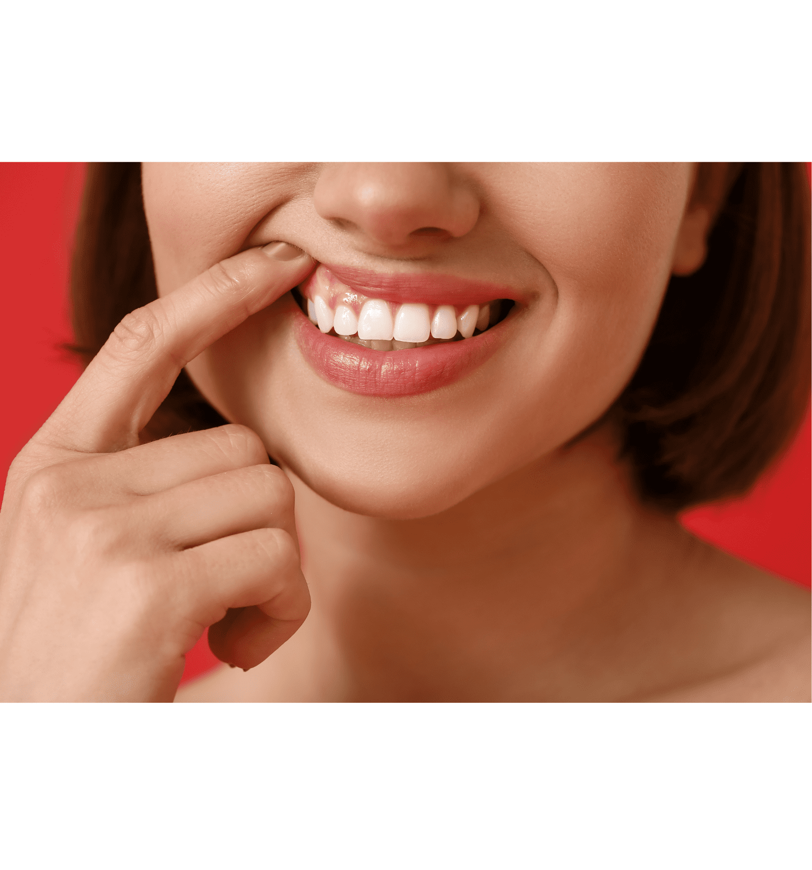 What Are Gum Graft Alternatives | The Expert's Take