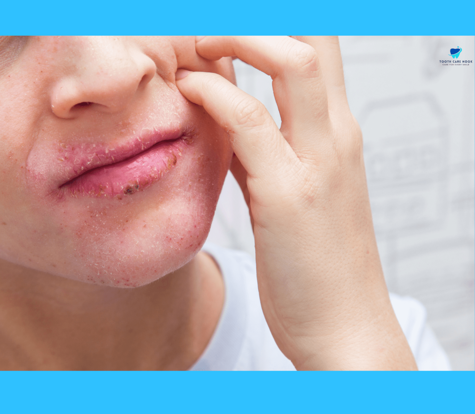 What Are Coil Springs For Braces?| Purpose, Types, And All