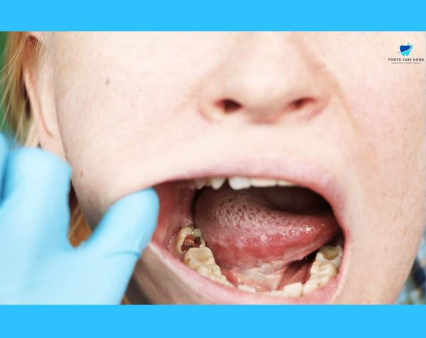 What is Buccal Dentistry | All You Need to Know