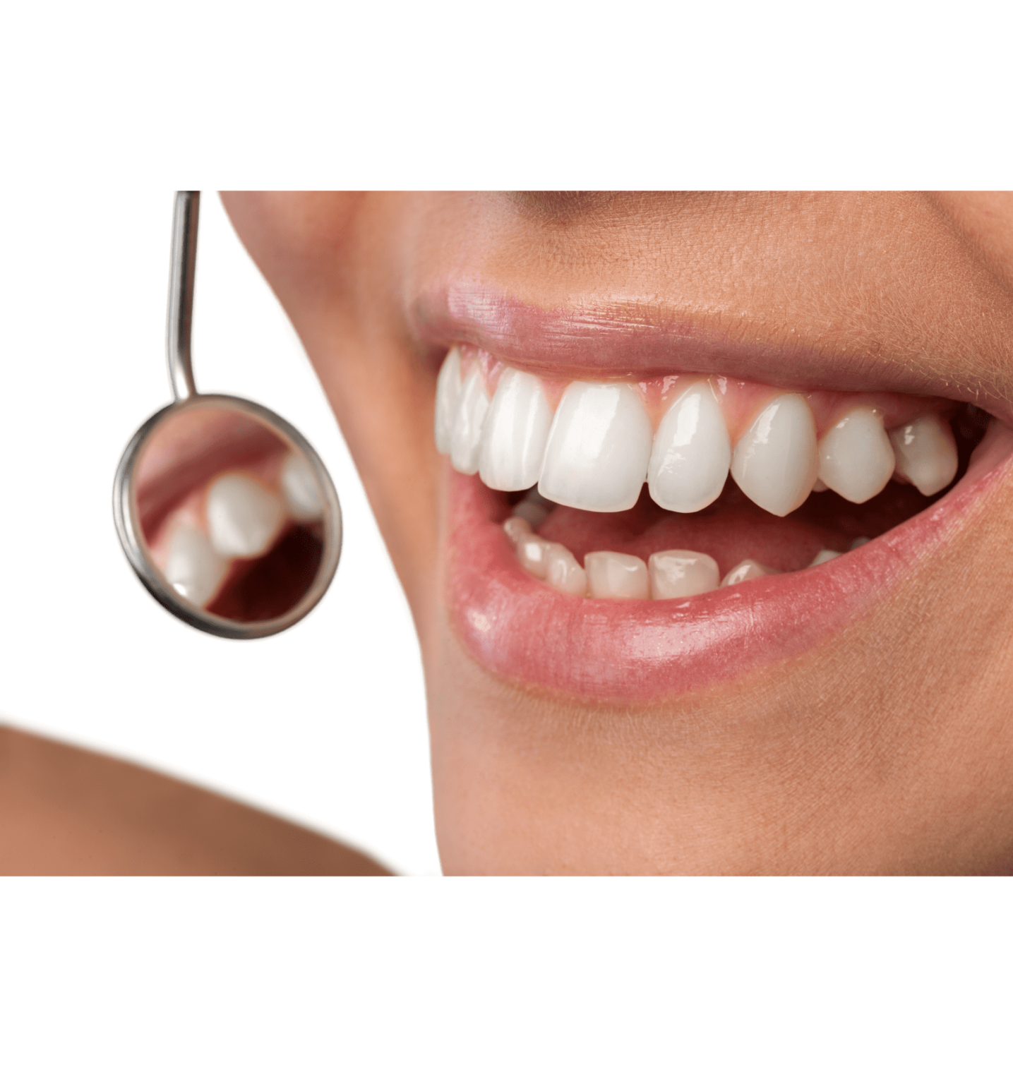 Know All About Different Shaped Teeth in Mouth