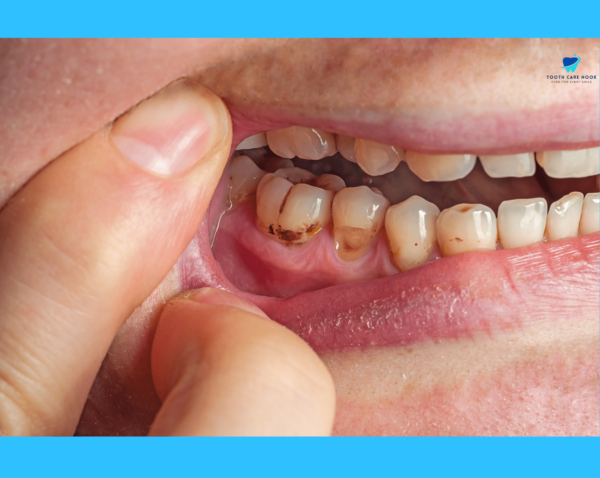 Do Your Teeth Keep Growing | Here's What You Need to Know
