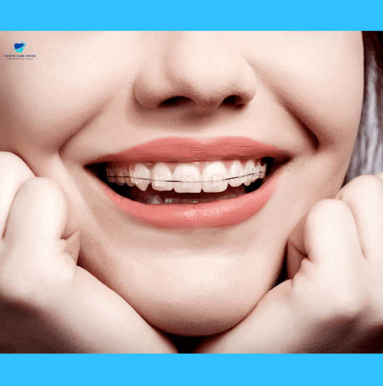 What is Thickest Wire For Braces? | A Guide to Types, And Sizes