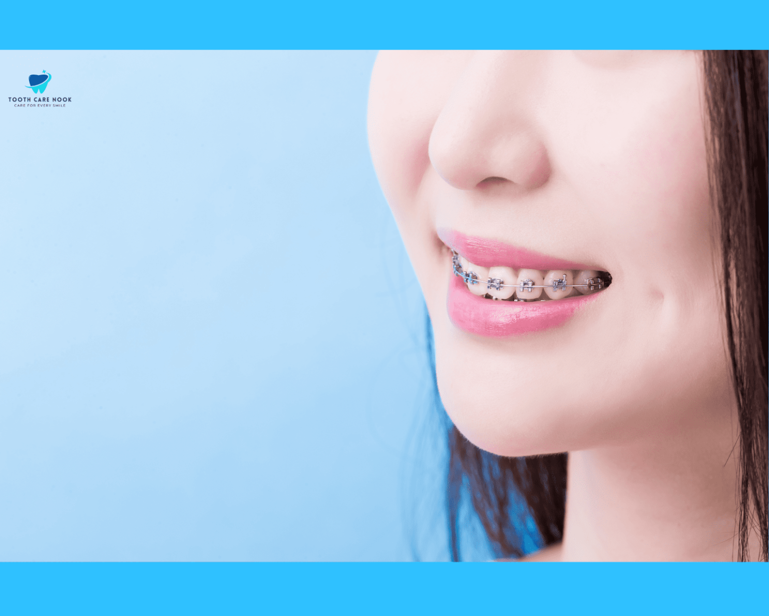 Temporary Anchorage Devices (TADs) For Braces | Know it All