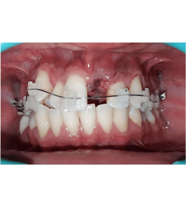 What Is Adjunctive Dental Care | A Comprehensive Guide