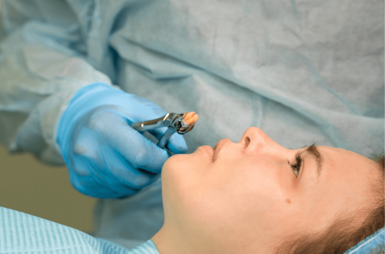 All About Liver Clot After Tooth Extraction A Detailed Guide All About Liver Clot After Tooth Extraction A Detailed Guide