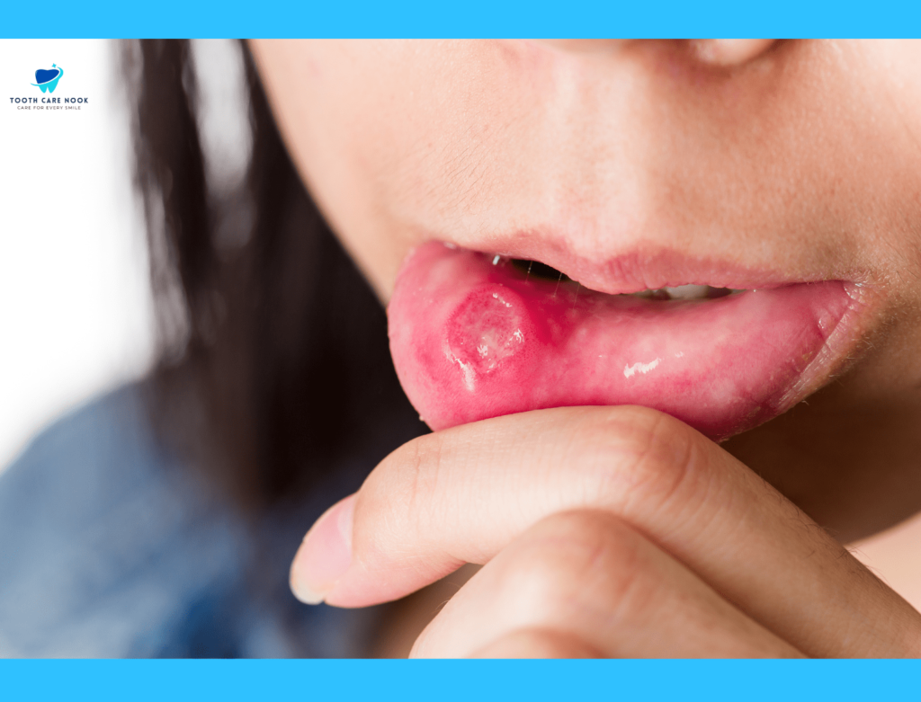 What Is Ankylosis Of Teeth - Causes, Treatment, And All