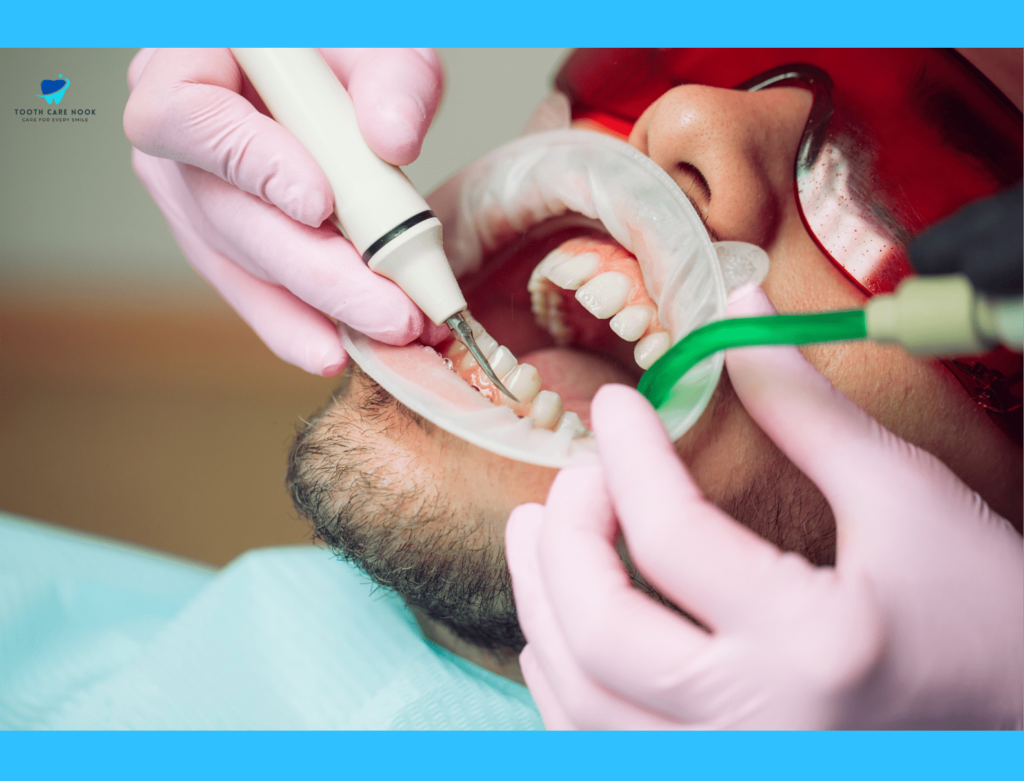 What is Internal Teeth Whitening | Benefits, Side Effects, And All