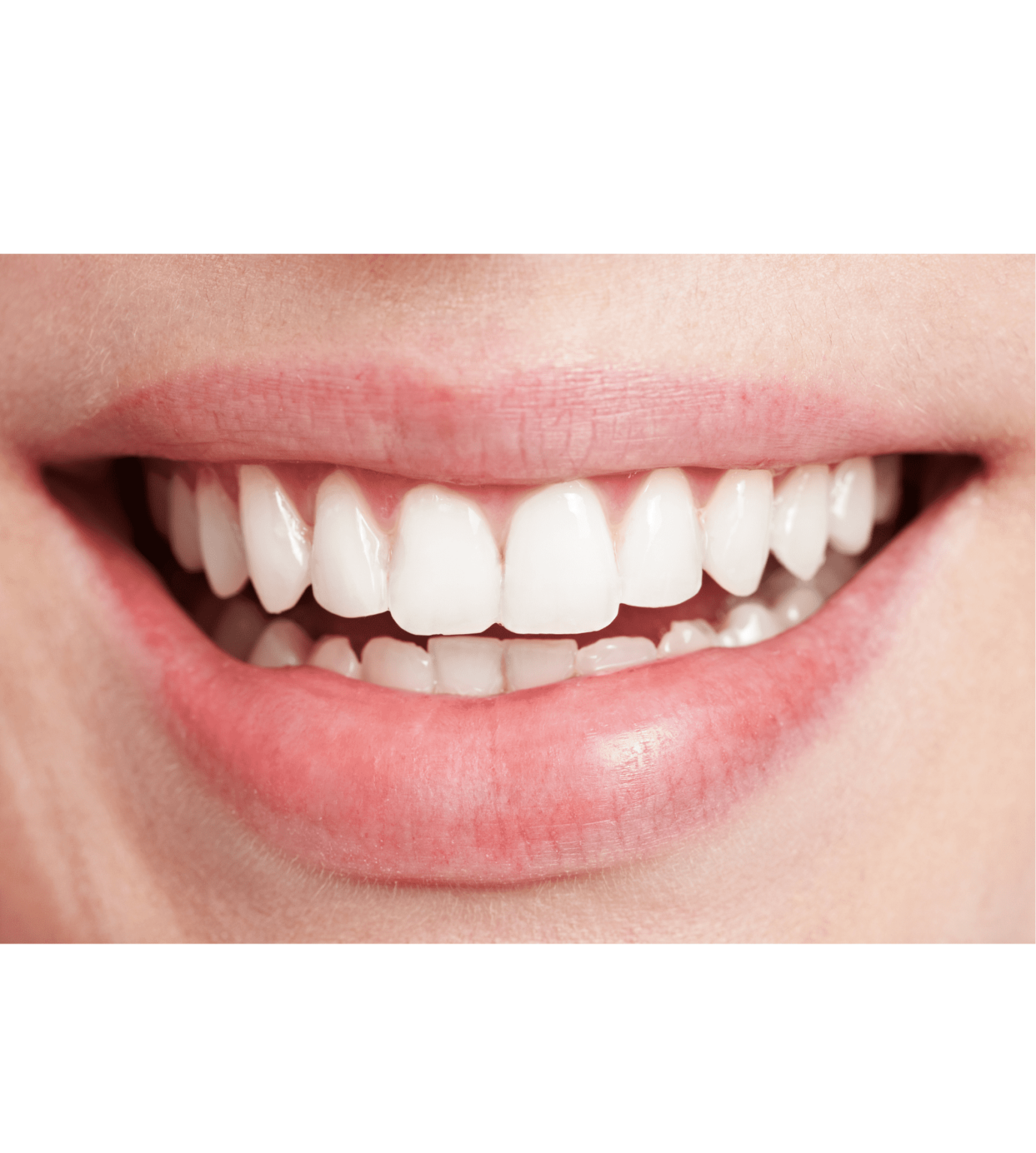 What Are Chiclets Teeth? | All You Need To Know