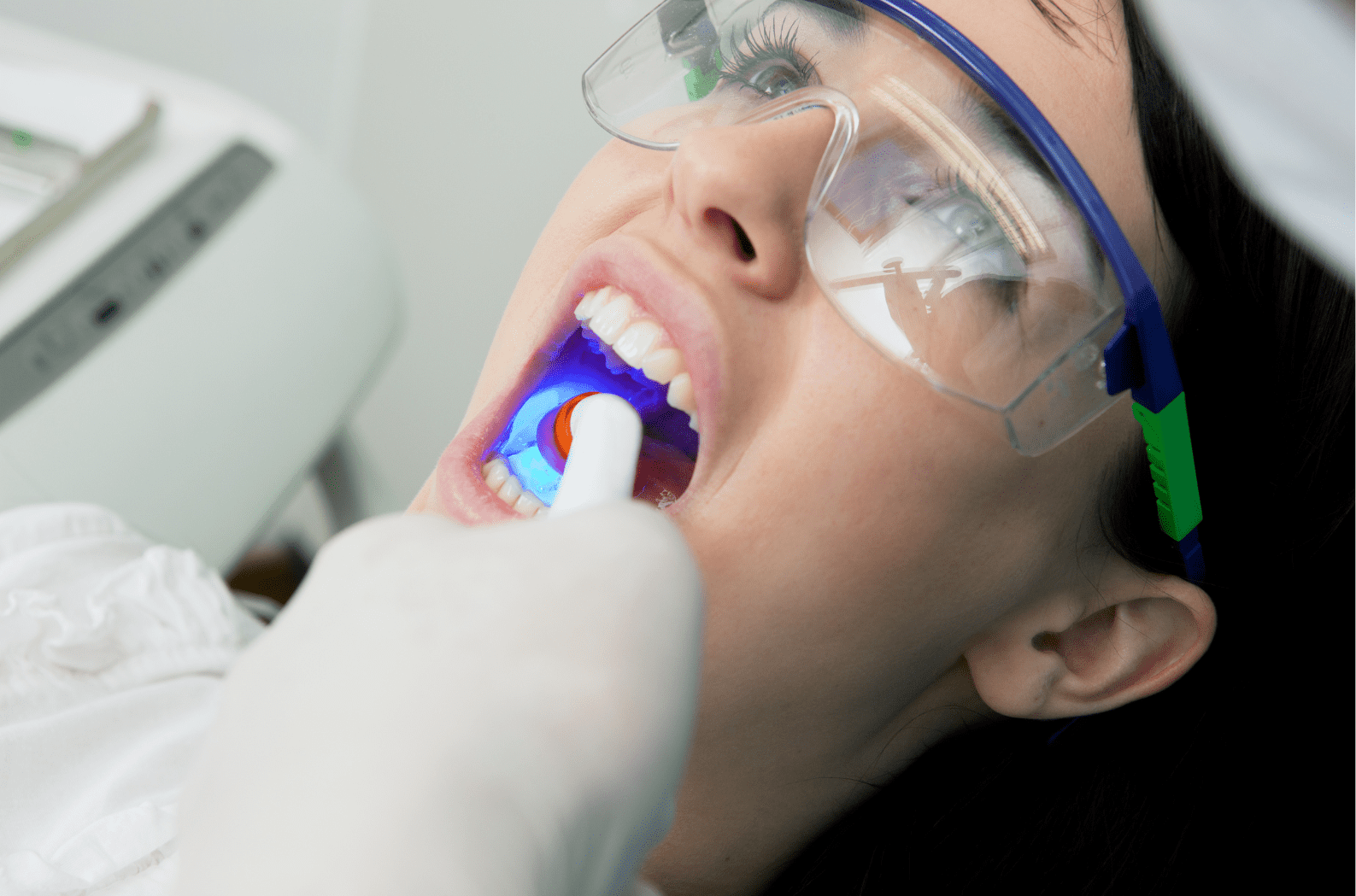 What Causes Leaking Dental Fillings | Here's What Experts Say