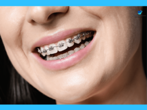 Why Do The UK Have Bad Teeth? | A Dental Mystery Solved