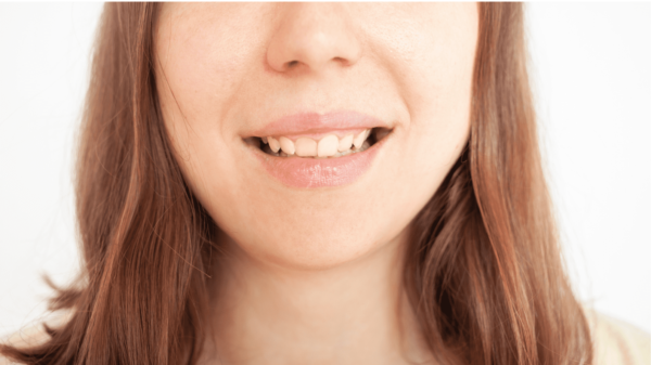 Why Do The UK Have Bad Teeth? | A Dental Mystery Solved