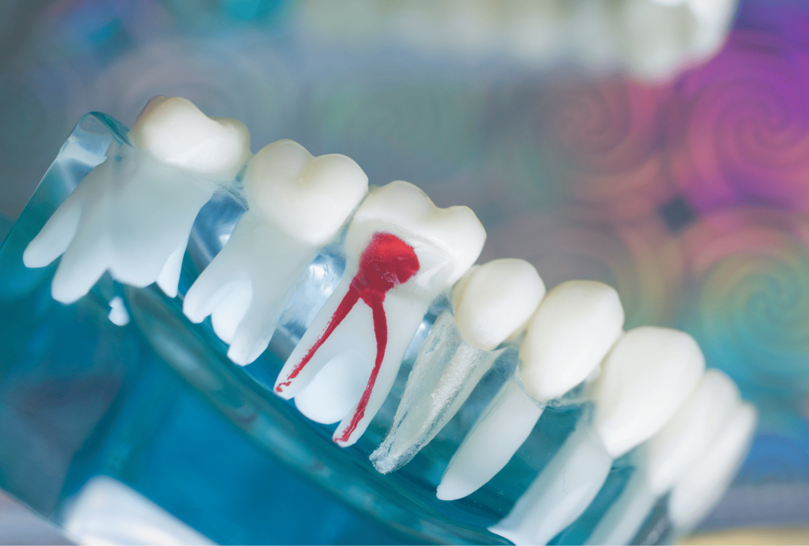 My Teeth Are Rotting And I Have No Money - What Should I Do?