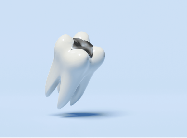 What Are The Causes Of Black Lines On Teeth Molars? | A Guide